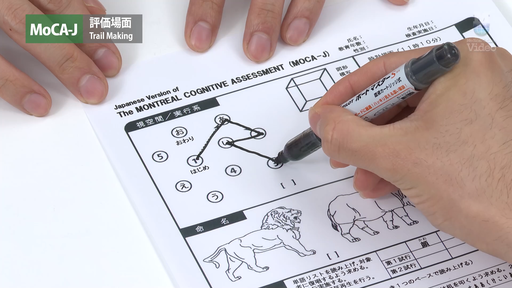 MoCA-J 概要解説・評価場面 ｜ Medical*Online Video