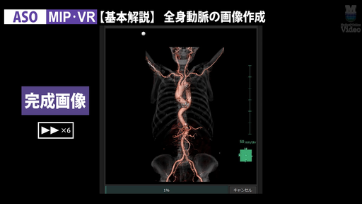 特集「3DCT 画像作成の徹底解説！！」 ｜ Medical*Online Video