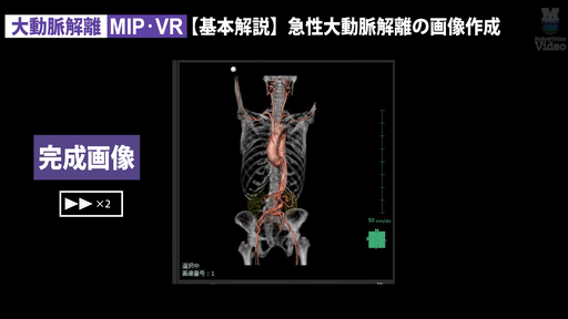 特集「3DCT 画像作成の徹底解説！！」 ｜ Medical*Online Video